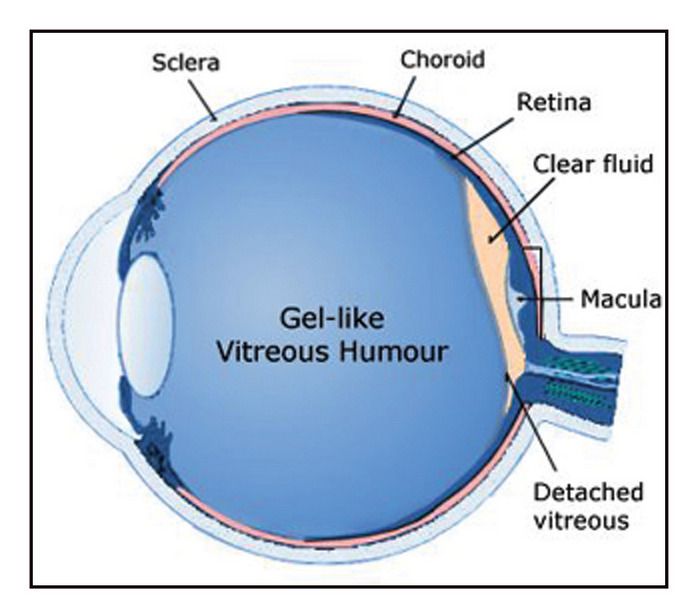 Floaters | Ipoh Echo
