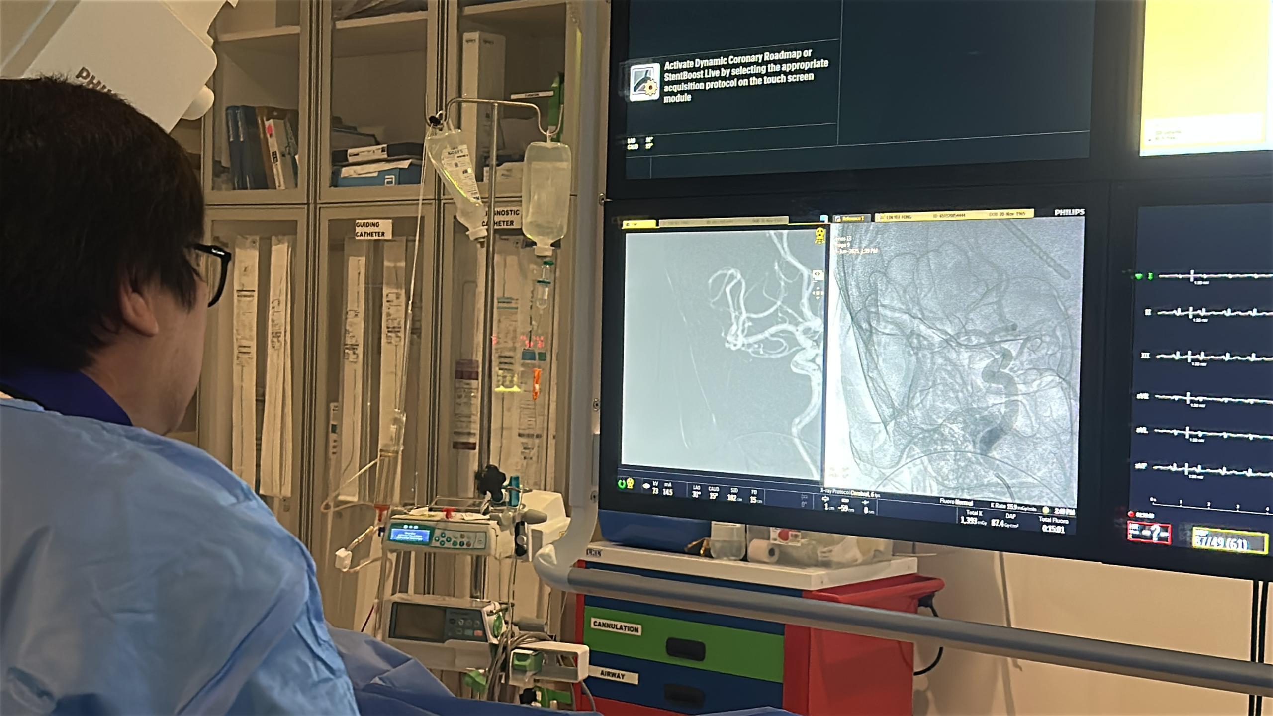 PCSH Makes History with First Successful Brain Aneurysm Coiling ...